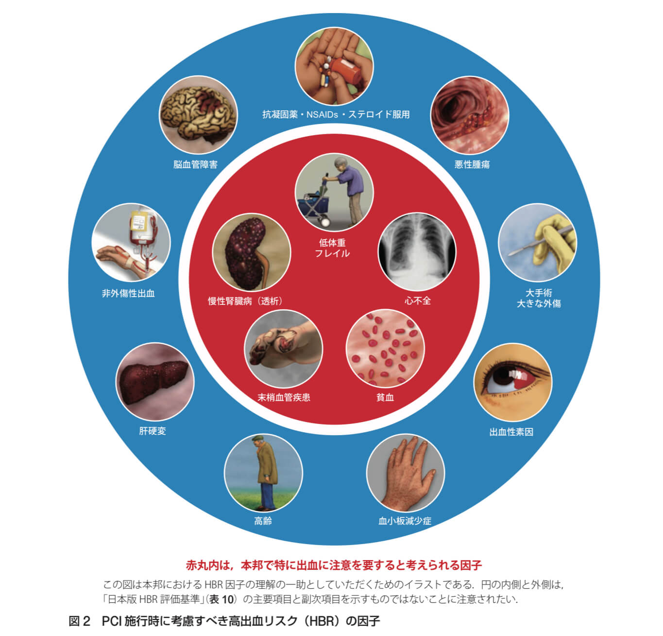 PCI後のDAPTはどのくらい続けるの？ | KusuriPro-くすりがわかる！薬剤師ブログ